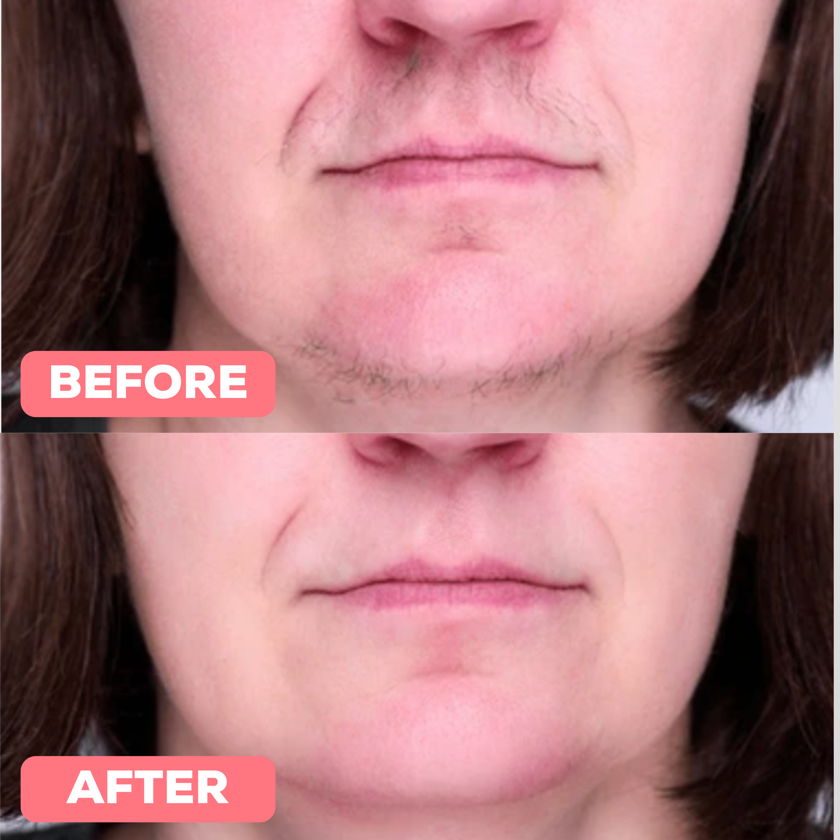 PLuxe Pro Epil - 50% OFF!